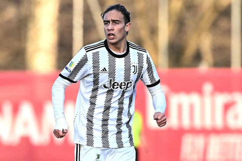 Allegri, Kenan Yıldız'ın saçına taktı - Ensonhaber